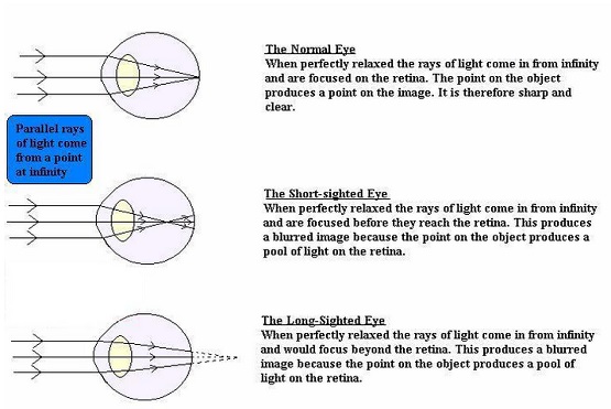 Structure And Working Of Human Eye Physics Wallah structure-and-working-of-human-eye-physics-wallah